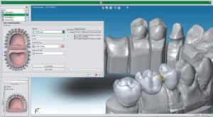 STRAUMANN® CARES® SCAN CS2 – Ceramics Dental Lab North Miami Beach