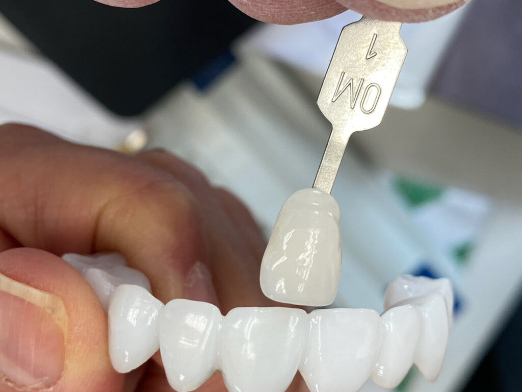 Services – Ceramics Dental Lab North Miami Beach